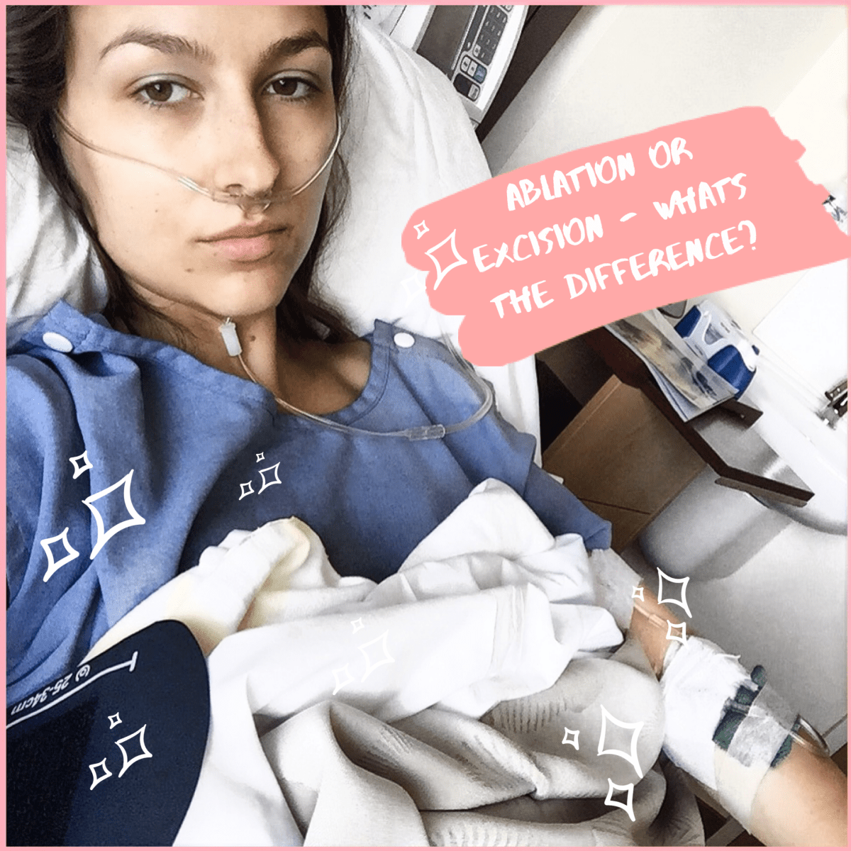 Endometriosis Surgery – Excision vs. Ablation – All About Annie